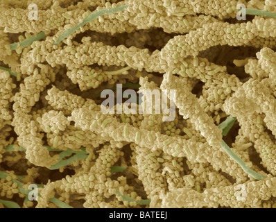 Plaque-bildende Bakterien, farbige Scanningelectron Schliffbild (SEM ...