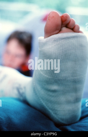 Fuß in Gips, Füße im Rollstuhl Stockfoto, Bild: 34380948 - Alamy