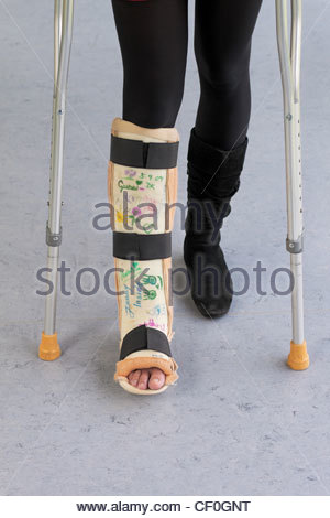 Frau mit gebrochenem Bein Stockfoto, Bild: 24588078 - Alamy