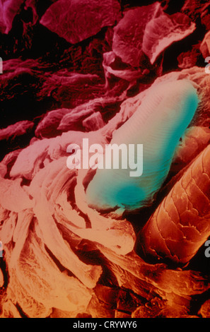 Milbe (Demodex Folliculorum Stockfotografie - Alamy