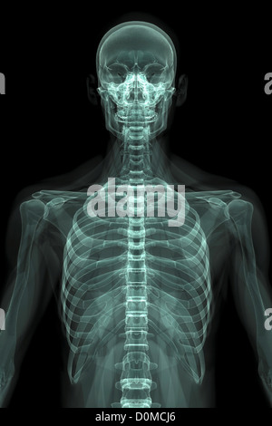 Röntgenbild zeigt den Brustkorb und Becken Stockfotografie - Alamy