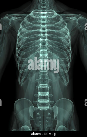 Röntgenbild zeigt den Brustkorb und Becken Stockfotografie - Alamy