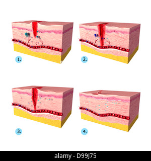 Anatomie der Reparatur von Gewebe in der menschlichen Haut ...