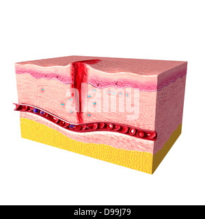Anatomie der Reparatur von Gewebe in der menschlichen Haut ...