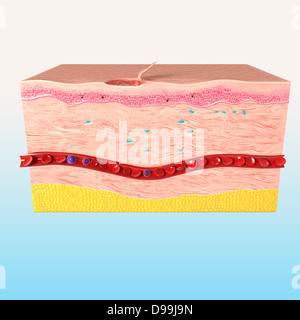 Anatomie der Reparatur von Gewebe in der menschlichen Haut ...