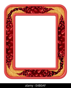 Die Bildung von Cholesterin, Fett, Arterie, Vene, Herz. Einengung der ...