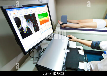 KNOCHEN DENSITOMETRIE UNTERSUCHUNG Stockfotografie - Alamy
