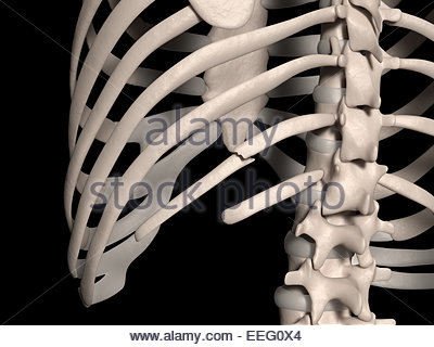 Abbildung einer Rippe Fraktur Stockfotografie - Alamy