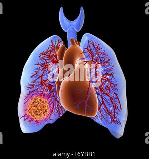 Lungenvenen und Arterien Stockfoto, Bild: 24065877 - Alamy