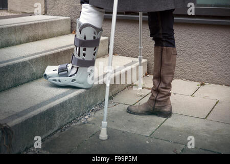 Nahaufnahme der Frau zu Fuß mit Gips und Krücken Stockfotografie - Alamy