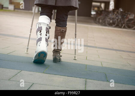 Nahaufnahme der Frau zu Fuß mit Gips und Krücken Stockfotografie - Alamy