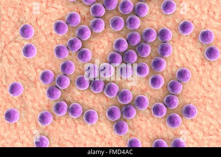 Computer-Darstellung der Staphylokokken-Bakterien (Staphylococcus ...