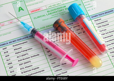 Blut-Ampullen und Spritze mit Nadel auf Laborergebnisse Stockfotografie ...