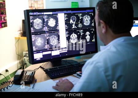 MRT des Gehirns. Schädel Röntgen Stockfoto, Bild: 69696567 - Alamy