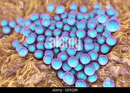 Computer-Darstellung der Staphylokokken-Bakterien (Staphylococcus ...