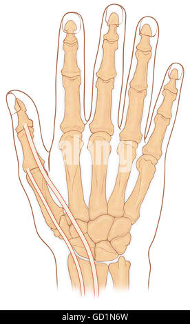 Normale Ansicht von ventral der Ulna, Radius, Hand-Bones, hamate ...