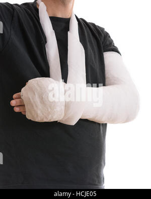 Mit Gipsarm - helle weiße lange Gipsarm in einer Schlinge für einen ...