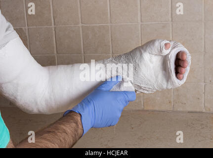 Arzt Patienten Unterarm und Handgelenk ein Gipsverband und Bandagen ...
