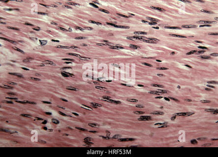 LM der glatten Muskulatur Stockfotografie - Alamy