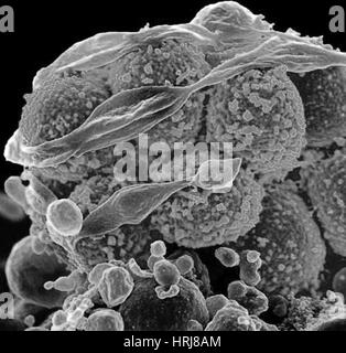 Staphylococcus Aureus Bakterien, MRSA, SEM Stockfotografie - Alamy