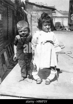 Mädchen mit Rachitis Stockfoto, Bild: 134945399 - Alamy