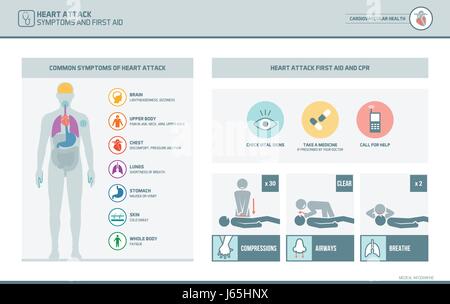 Heart Attack Warnungen und Symptome Infografik und erste Hilfe cpr ...
