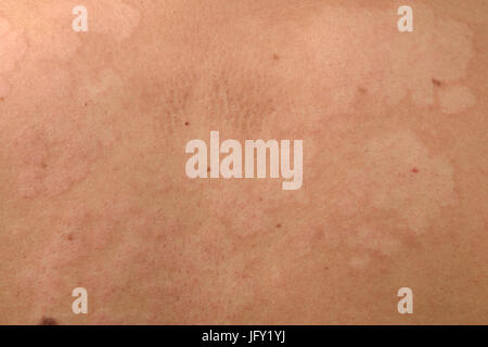 Detail der Haut Pilz zurück Stockfoto, Bild: 147497039 - Alamy