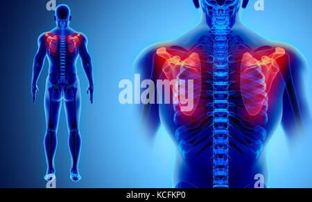 Röntgenaufnahme einer menschlichen Schulter Stockfoto, Bild: 56242573 ...