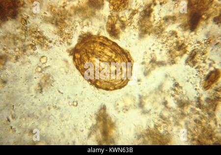 Ascaris Lumbricoides Cdc Atlas Archive – Controllab