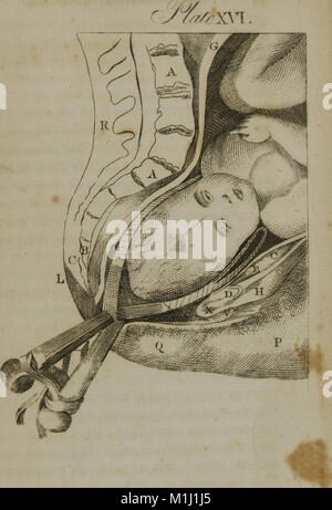 . Eine Reihe von anatomischen Tabellen, mit Erläuterungen und eine ...