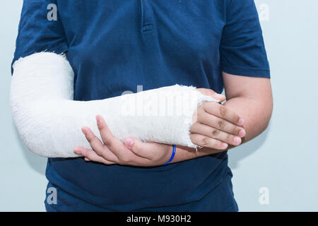 Nahaufnahme eines jungen Mannes Fiberglas / Gips Gipsbein und Zehen ...