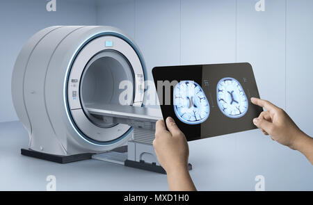 MRT des Gehirns mit der Alzheimer-Krankheit Stockfoto, Bild: 134986849 ...