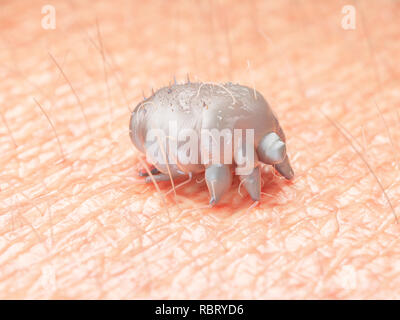 Abbildung einer scabies mite auf die menschliche Haut Stockfotografie ...