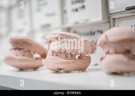 Dental Gießen Gips modellieren Gips Stomatologie-menschliche Kiefer ...