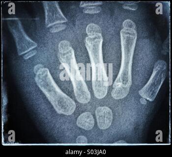 Anatomie der Knochengelenke des menschlichen Skelettsystems ...