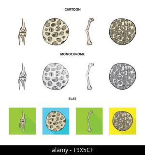 Femur, Osteoporose, Bony, Zelle, Gewebe, Bein, Knie, Bindegewebe ...