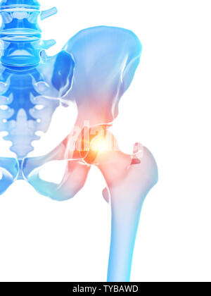 Schmerzen im Beckenbereich, artwork Stockfoto, Bild: 65237100 - Alamy