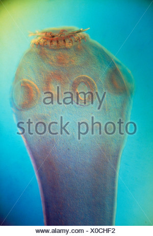 Bandwurm, leichte Schliffbild (Kopf-wie Struktur) der eine parasitäre ...