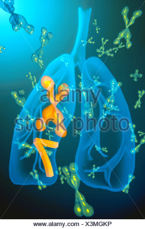 Zystische Fibrose Chromosom, Illustration. Mukoviszidose ist eine ...