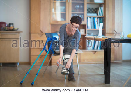 Frau mit gebrochenem Bein Stockfoto, Bild: 24588035 - Alamy