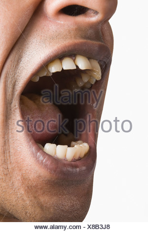 Blick auf die weit geöffneten Mund und Zungenspatel überprüft Kind ...