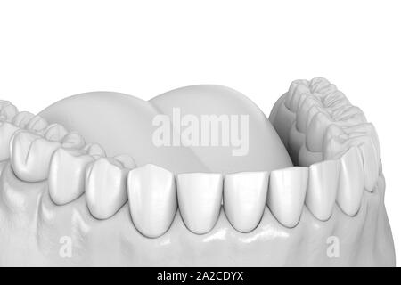 Anatomie dentaire des dents et gencives humaine mandibulaire, la vue x-ray. Dent précise ...