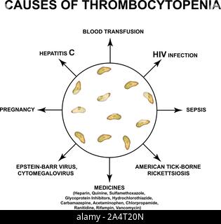 Causes d'une thrombocytose. Une augmentation des plaquettes dans le ...