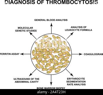 Causes d'une thrombocytose. Une augmentation des plaquettes dans le ...