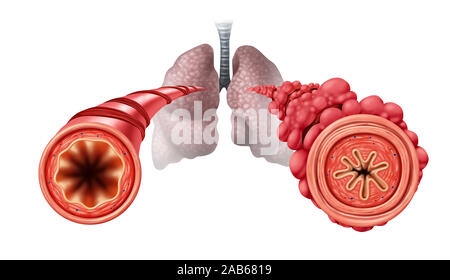 Concept de l'anatomie de la Bronchite inflammation de la muqueuse du ...
