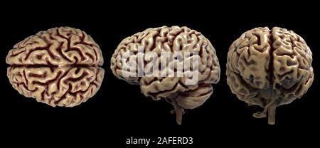 Rendu réaliste de l'anatomie du cerveau humain - modèle en trois ...