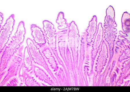 L'intestin grêle. Microphotographie lumière d'une section à travers le ...