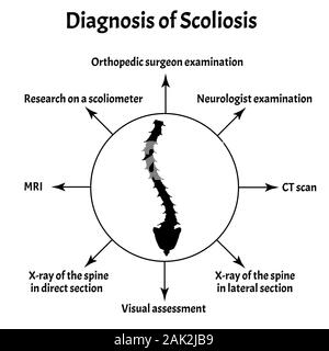 Symptômes de lordose. La courbure de la colonne vertébrale, la scoliose ...