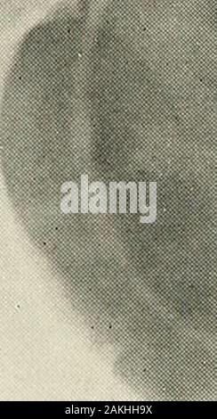 (Pyelo-ureterography La pyélographie) une étude de l'anatomie normale ...