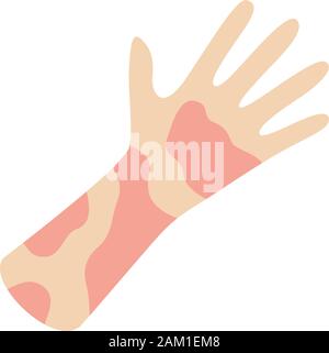 La dermatite de contact, de l'urticaire l'icône de couleur. La rougeur ...